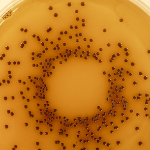 Bismuth Sulphite Agar Base A | Labema - life science - ja bioteknologia ...