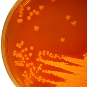 Hektoen Enteric Agar | Labema - Life Science and Biotechnology expert